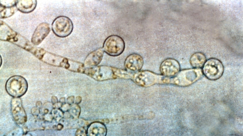 Rezzayo antifungal okayed as Candida auris rings alarm bells | pharmaphorum