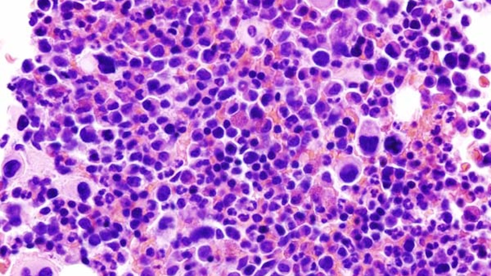MSD starts second phase 3 of Imago drug for blood cancers | pharmaphorum