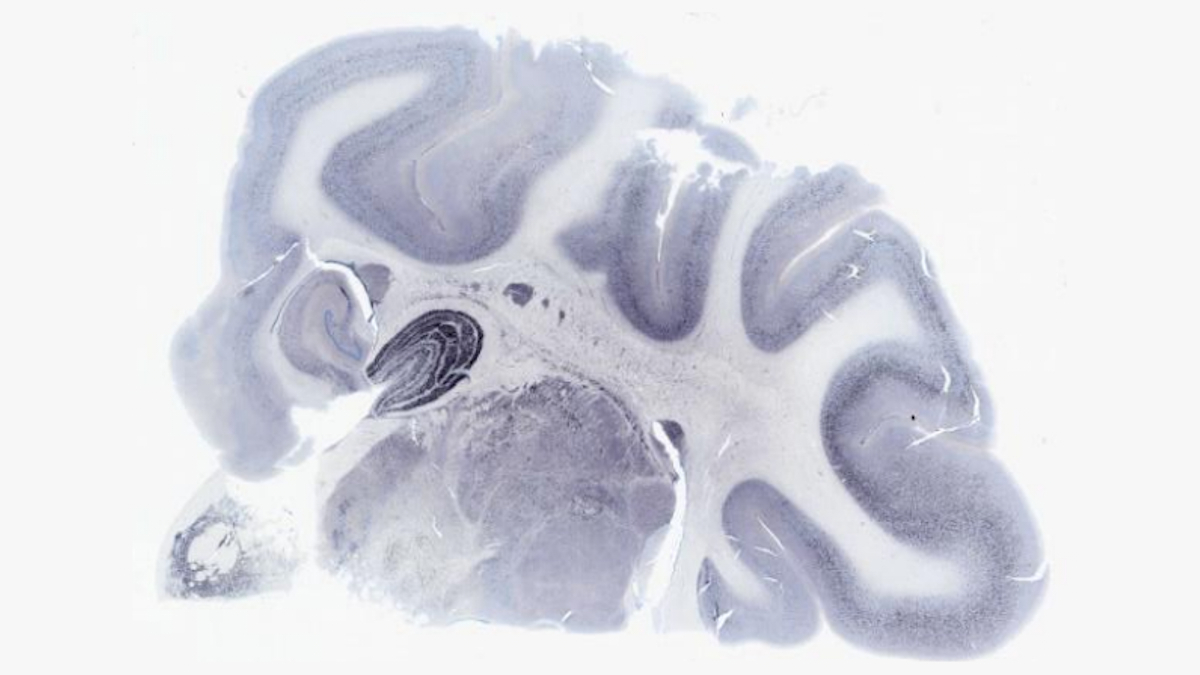 Lilly throws lifeline to Sangamo with $1.4bn licensing deal | pharmaphorum