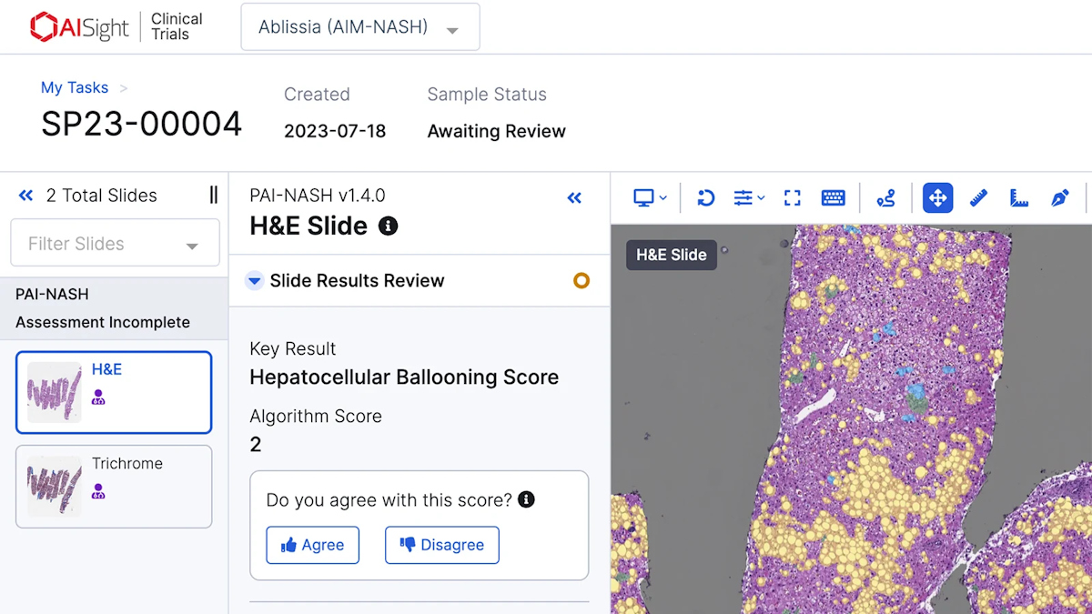 FDA backs first AI tool for use in trials, targeting MASH | pharmaphorum