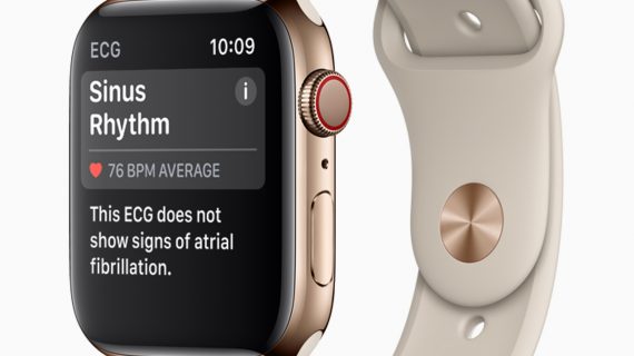 AliveCor pledges to outdo Apple Watch with 6-lead ECG